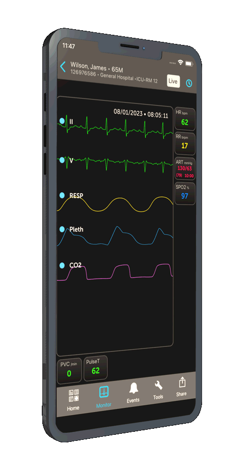 AirStrip® | Workflows | Patient Waveforms